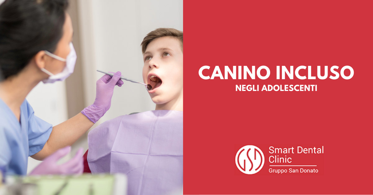 Canino incluso - Smart Dental Clinic